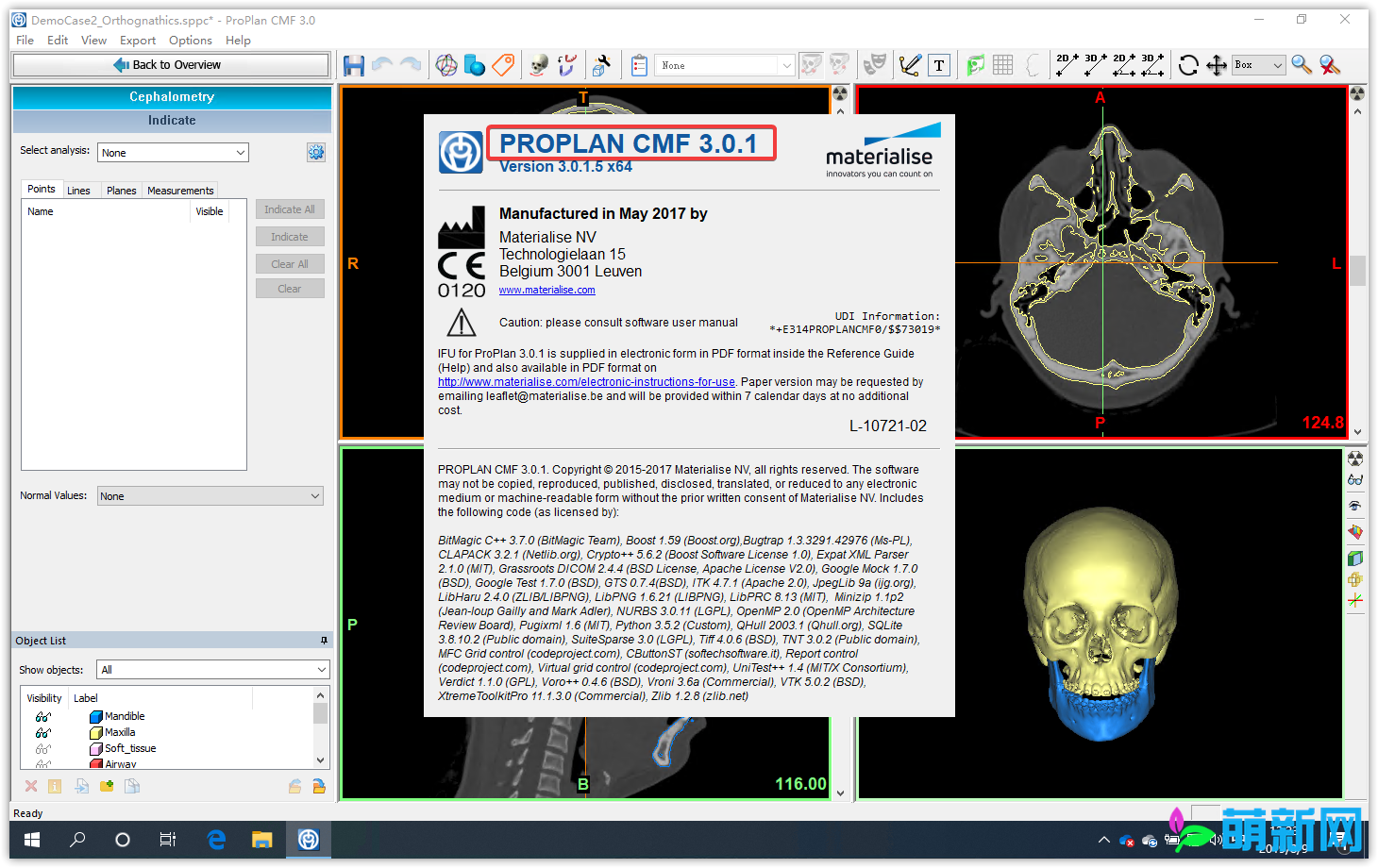 Materialise ProPlan CMF v3.0.1 完美激活版 强大的医学软件 - MAC萌新网